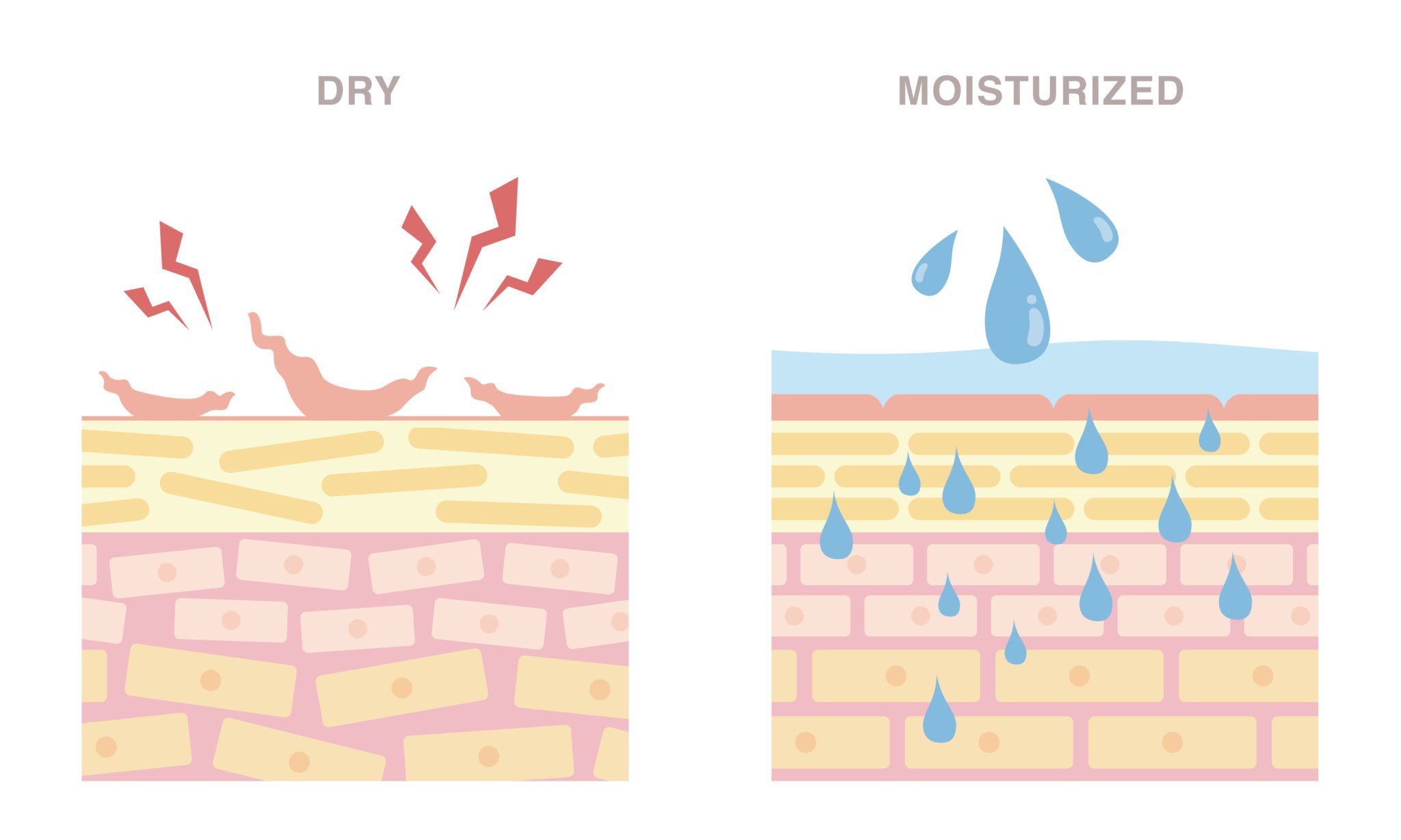 Pelle secca: cause, sintomi, rimedi naturali e consigli di alimentazione